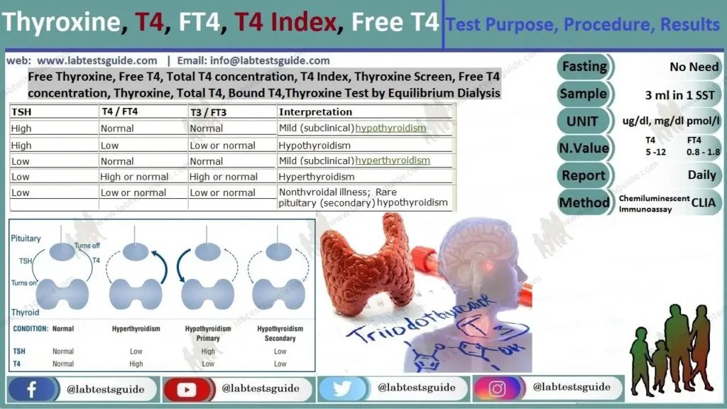 Free T4 Test Purpose Procedure Result Interpretation And More Free T4 Test Purpose Procedure Result Interpretation And More
