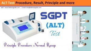 ALT Test Procedure, Result, Principle And More | Lab Tests Guide