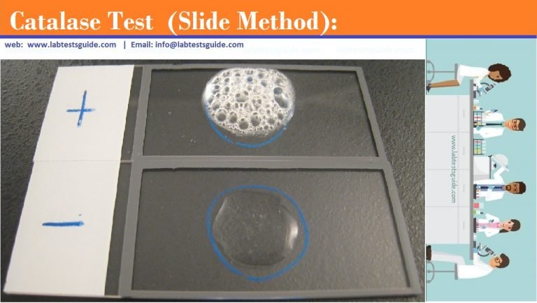 Catalase test : Principle, Procedure, Results and more | Lab Tests Guide