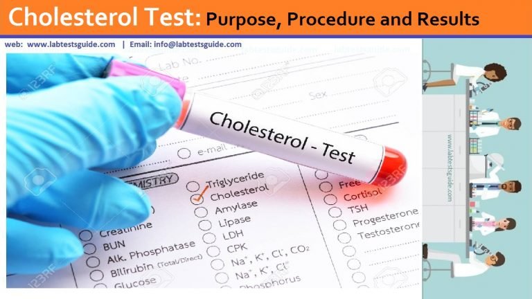 Cholesterol : Purpose, Procedure and Results | Lab Tests Guide