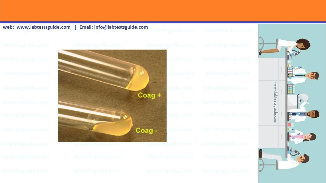 Coagulase Test : Principle, Procedure And Interpretation | Lab Tests Guide