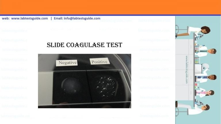 ACR Test Purpose, Procedure, Result And More | Lab Tests Guide