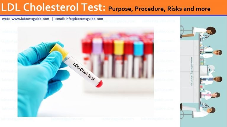 LDL Cholesterol : Purpose, Procedure, Risks and more - Lab Tests Guide