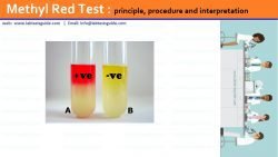Methyl Red Test : principle, procedure and interpretation - Lab Tests Guide