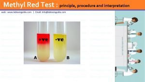 Methyl Red Test : Principle, Procedure And Interpretation | Lab Tests Guide