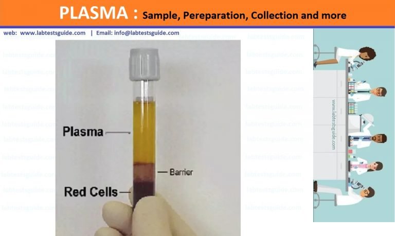 Plasma Sample, Pereparation, Collection and more | Lab Tests Guide