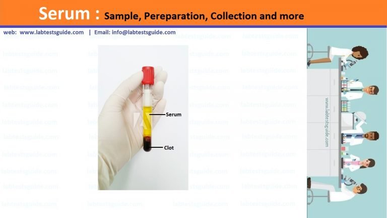 Serum Sample, Pereparation, Collection and more | Lab Tests Guide