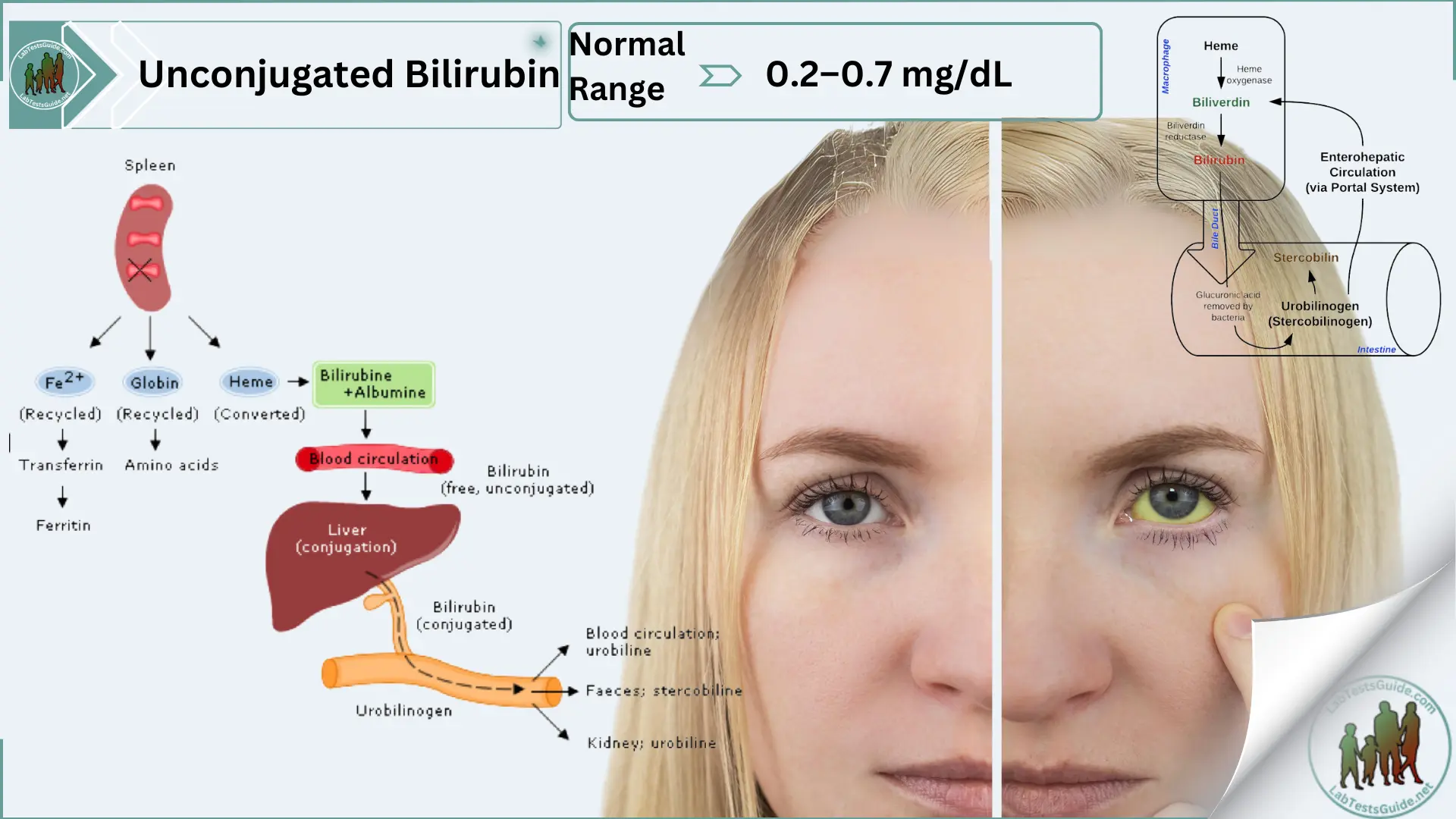 Unconjugated Bilirubin Test Purpose Procedure Result And More Lab Tests Guide