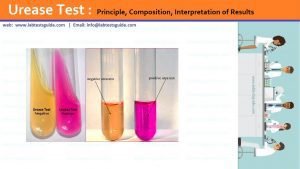 Urease Test : Principle, Composition, Interpretation of Results - Lab ...
