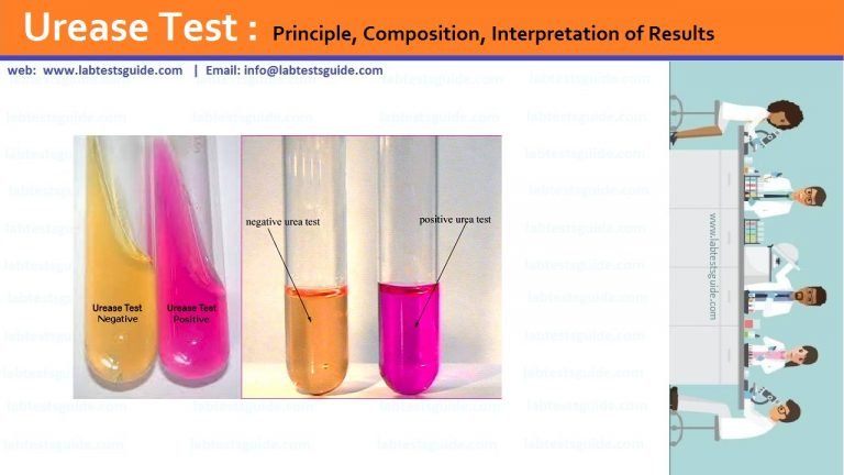 Urease Test : Principle, Composition, Interpretation of Results - Lab ...