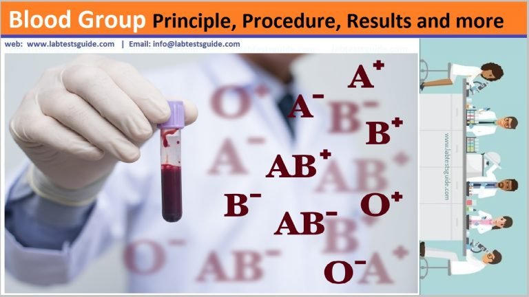 Blood Group Test Procedure, Results And More | Lab Tests Guide