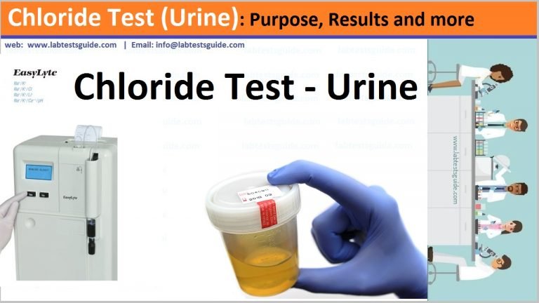 Chloride (urine) Test Purpose, Result and more - Lab Tests Guide