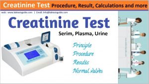 Creatinine Test Procedure | Lab Tests Guide