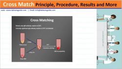 What is the difference between the major and minor crossmatch? | Lab ...