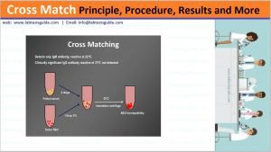What is the difference between the major and minor crossmatch? Archives ...