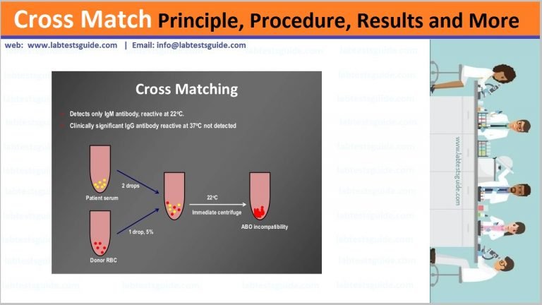 Cross Match Procedure, Principle, Results And More | Lab Tests Guide