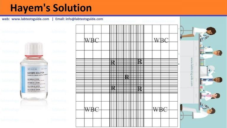 Giemsa Stain Principle, Results, Procedure And More | Lab Tests Guide