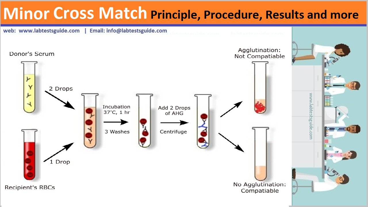 Minor Cross Match Procedure Principle Results And More Lab Tests Guide