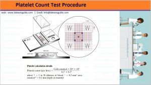 Platelet Count Test Procedure And Results | Lab Tests Guide