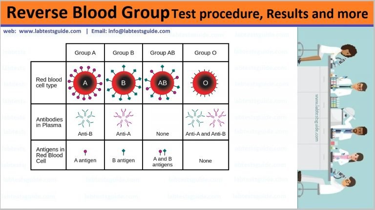 ABO Blood Groups And Rh Type Testing | Lab Tests Guide