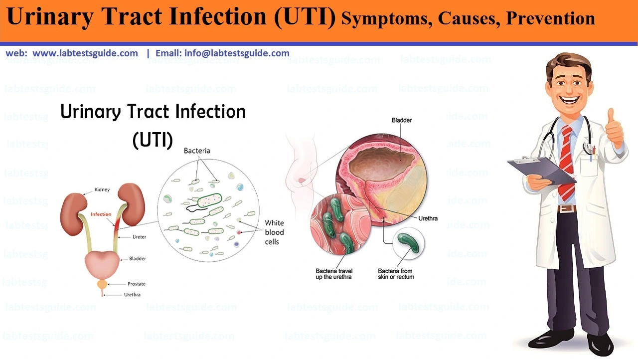 Urinary Tract Infections (UTI) Symptoms, Causes, Diagnosis and ...
