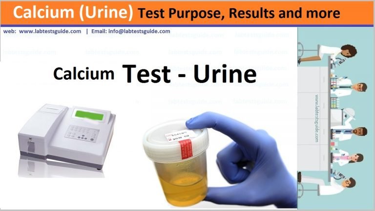 Calcium (Urine) Test Purpose, Causes, Overview and more - Lab Tests Guide