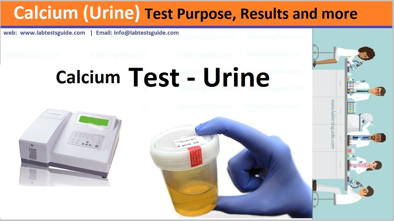 Calcium Urine Test Purpose Causes Overview And More Lab Tests Guide Calcium Urine Test Purpose Causes Overview And More Lab Tests Guide
