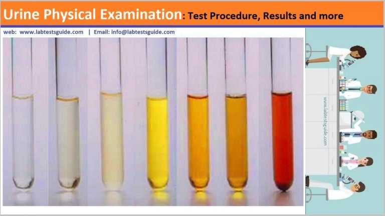 Urine Appearance , Color, Smell, Odor And More | Lab Tests Guide
