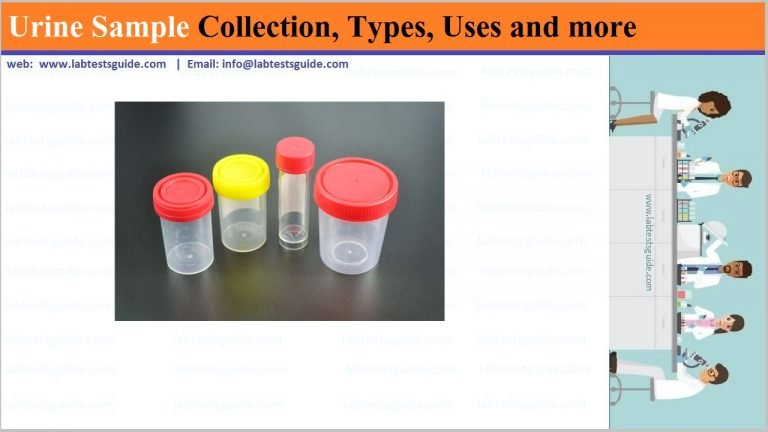 Urine Sample Collection, Types, Uses And More | Lab Tests Guide