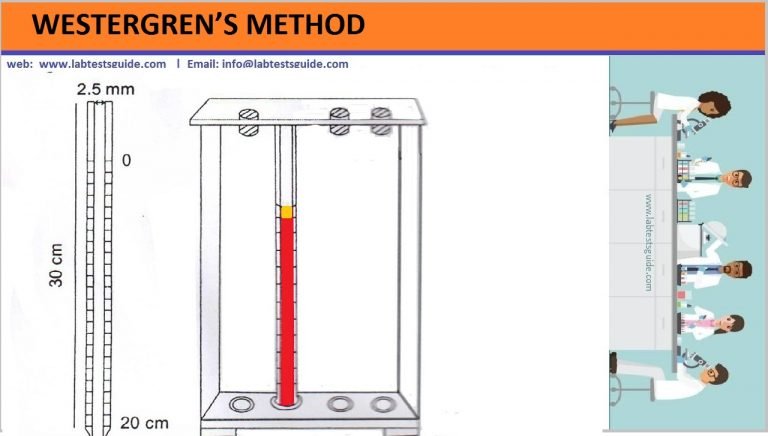 ESR Test Procedure and Results | Lab Tests Guide