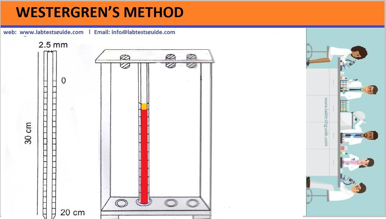 ESR Test Procedure and Results | Lab Tests Guide
