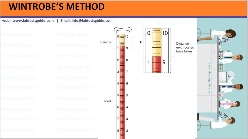 ESR Test Procedure, Principle, Result and more | Lab Tests Guide