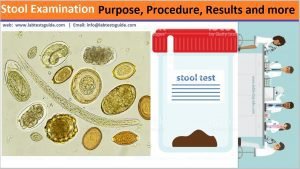Stool Examination Purpose, Procedure, Results And More | Lab Tests Guide