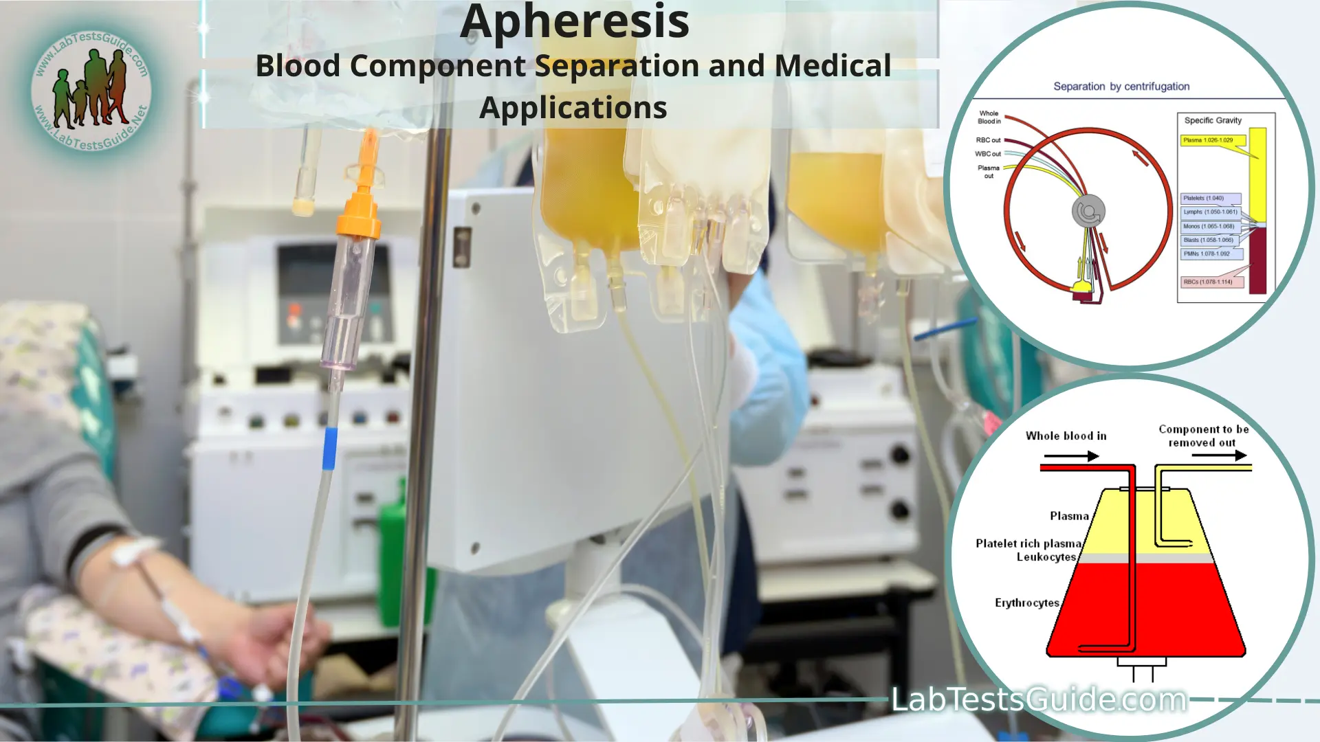 Apheresis: Blood Component Separation and Medical Applications