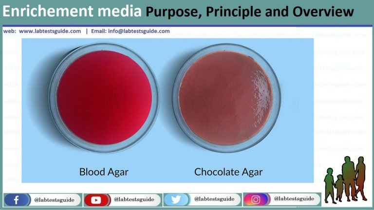 Enrichment Culture Media Purpose, Principle and overview - Lab Tests Guide