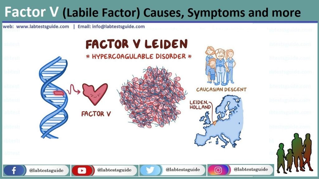 Factor V Labile Factor Causes Symptoms And More Lab Tests Guide Factor V Labile Factor Causes Symptoms And More Lab Tests Guide