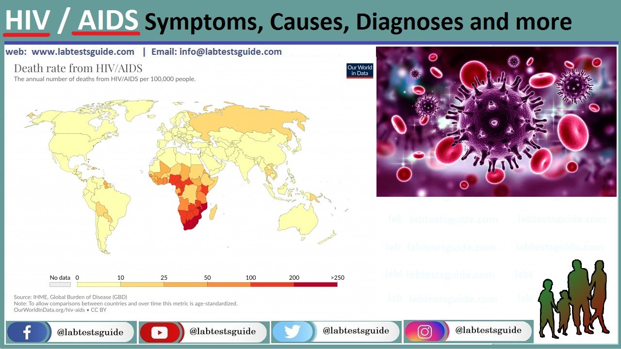 AIDS Symptoms, Causes, Treatment and more | Lab Tests Guide