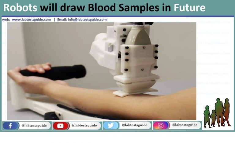 Robots will draw Blood Samples in Future - Lab Tests Guide