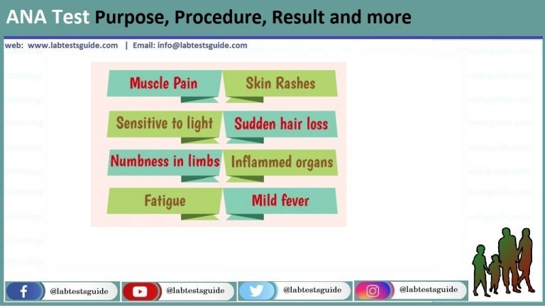 ANA Test Procedure, Results, Principle and more | Lab Tests Guide