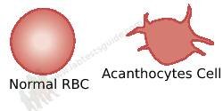 RBC Morphology Test Purpose, Procedure, Result and many more