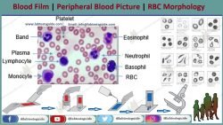 Blood Film Test Purpose, Procedure, Results And More | Lab Tests Guide