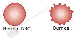 RBC Morphology Test Purpose, Procedure, Result and many more