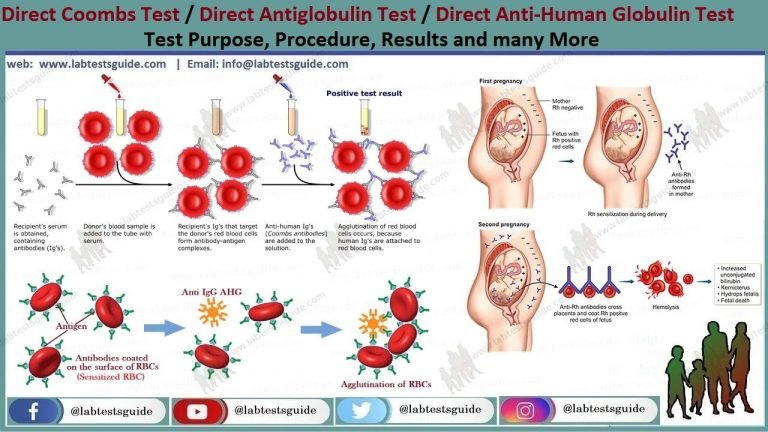 Direct Coombs Test Purpose, Result and more | Lab Tests Guide