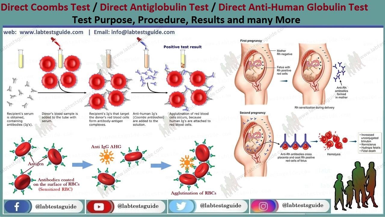 Direct Coombs Test Purpose, Result and more | Lab Tests Guide