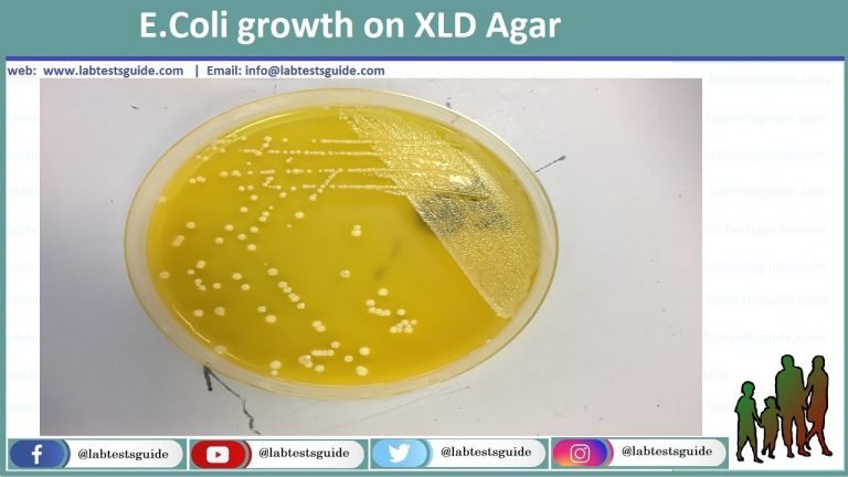 E. Coli Diagnosis, Procedure and Interpretation | Lab Tests Guide
