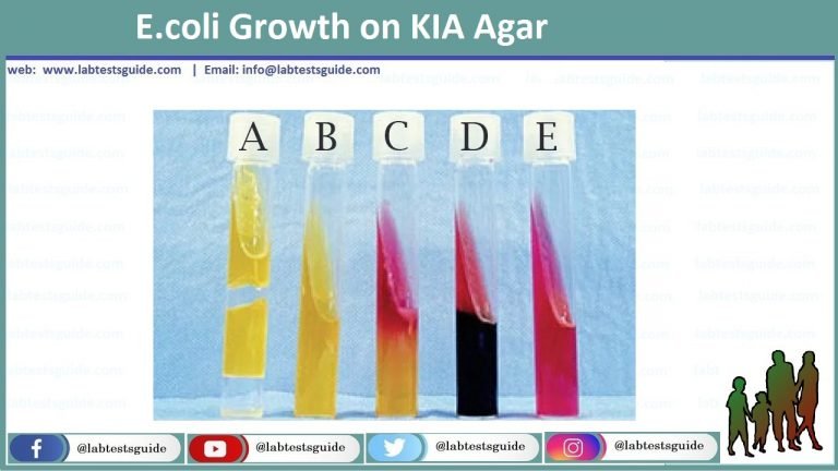 E. Coli Diagnosis, Procedure And Interpretation | Lab Tests Guide