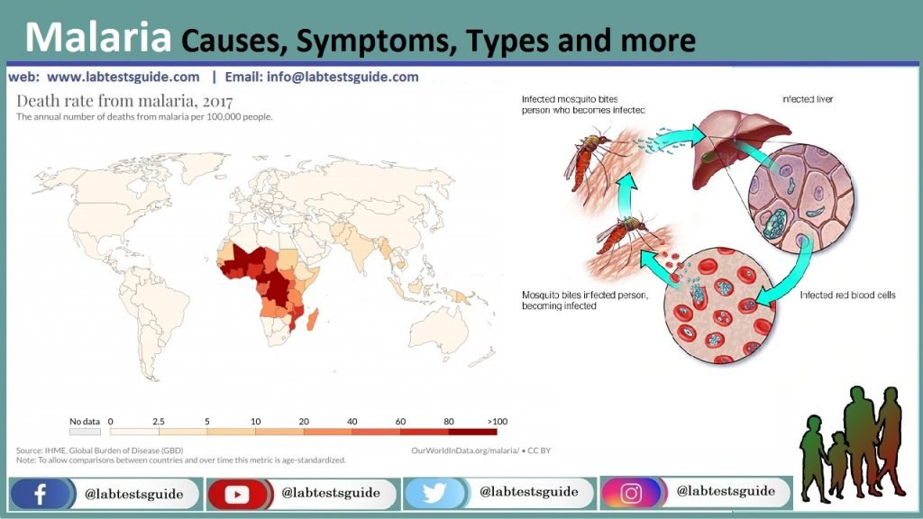 Malaria Causes, Symptoms, Types And More | Lab Tests Guide