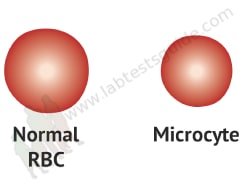 Blood Film | Lab Tests Guide