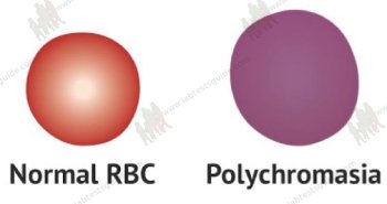 Red Blood Cell Morphology Test Purpose, Procedure, Result and many more