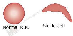 RBC Morphology Test Purpose, Procedure, Result and many more